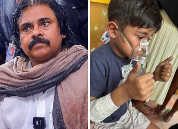 Photo of Pawan Kalyan’s son Mark Shankar after he gets injured in ...